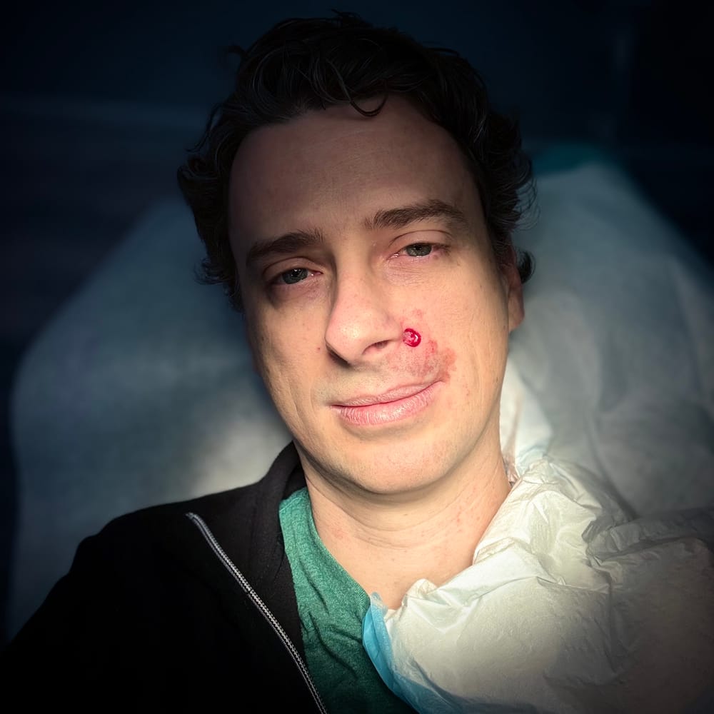 Surgery Day and the Aftermath